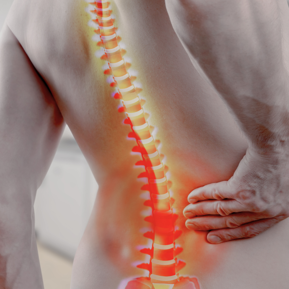 Discseel Procedure for Spondylolisthesis in Wisconsin | Non-Surgical Relief